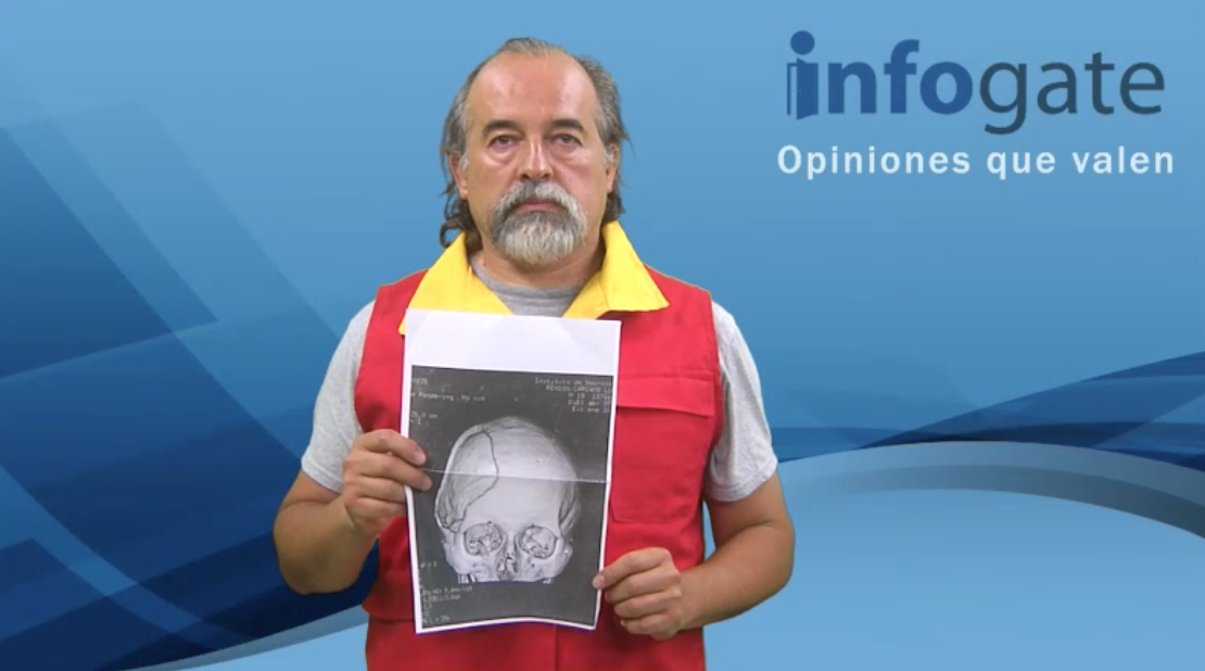 La opinión de Miguel Ángel Rendón | INFOGATE